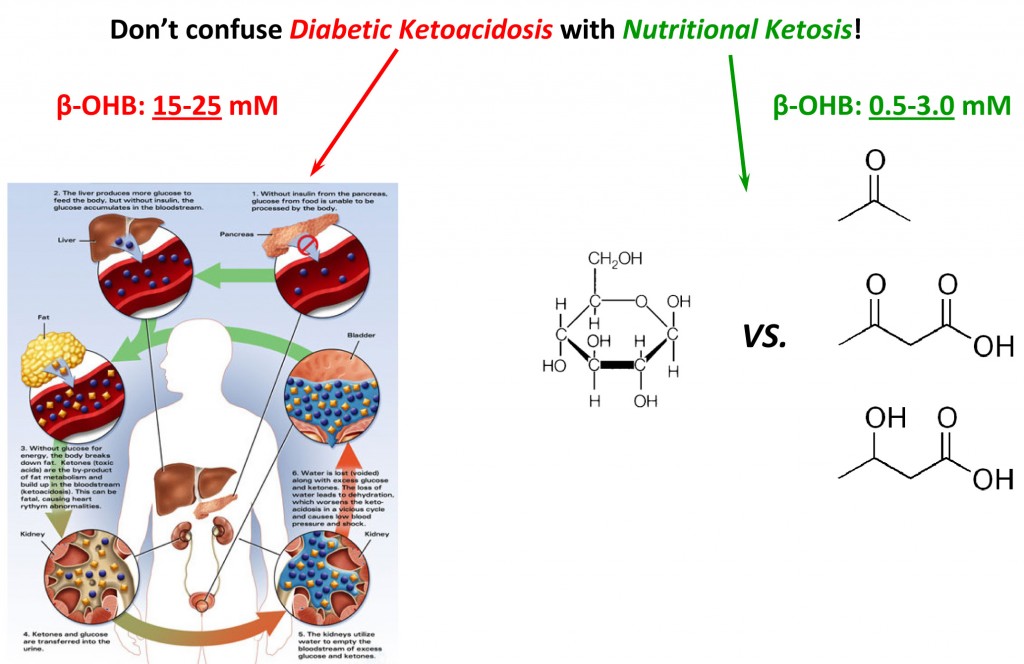 Dieta Cetogénica: Todo lo que necesitas saber