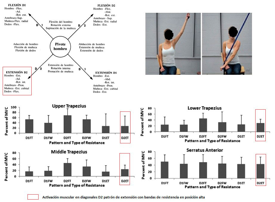 Hombro Inestable: Consejos para Deportes de Remate