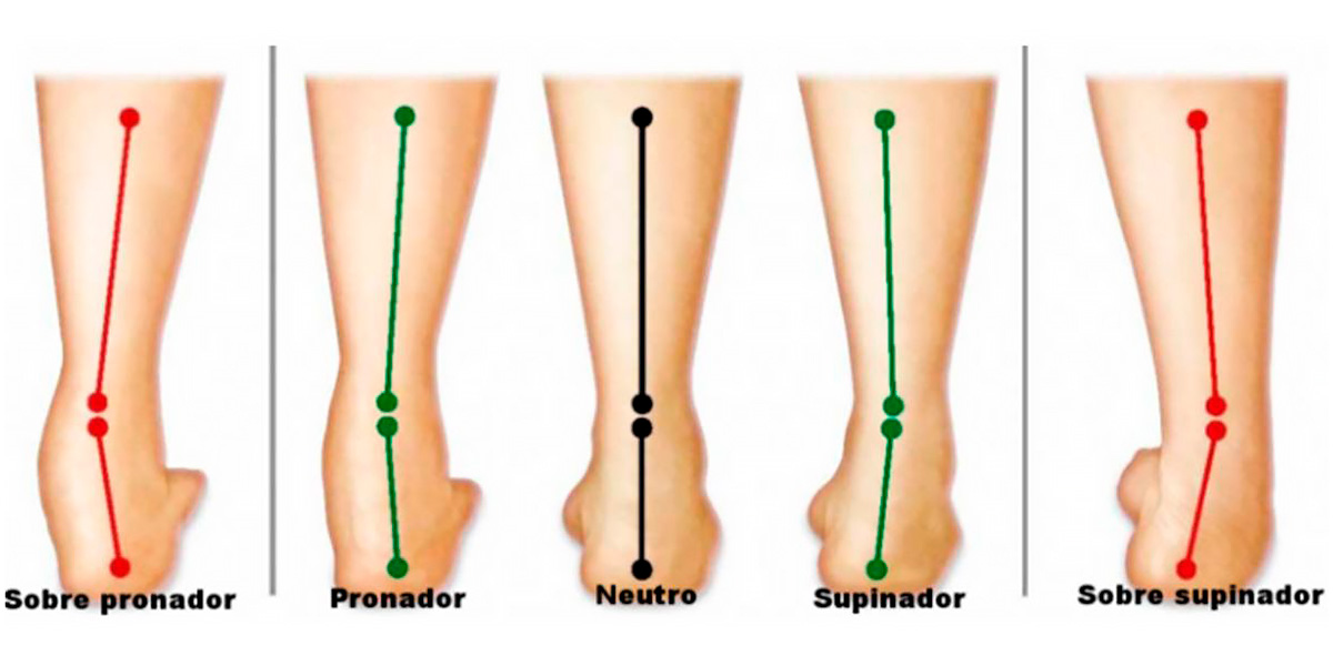 ¿Eres Pronador o Supinador? ¡Te contamos cómo averiguarlo!